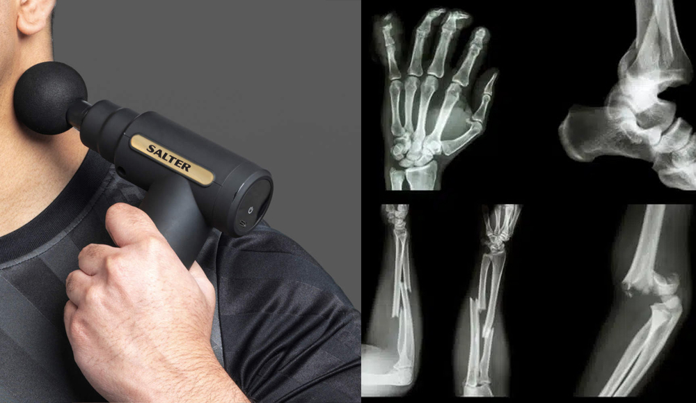 Man Shatters Entire Skeleton After Using Temu Massage Gun – Waterford ...